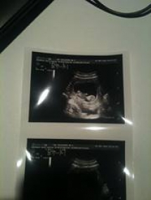 I'm Mimi Jacobson (Mimithepackleader) and these are a few of my ...